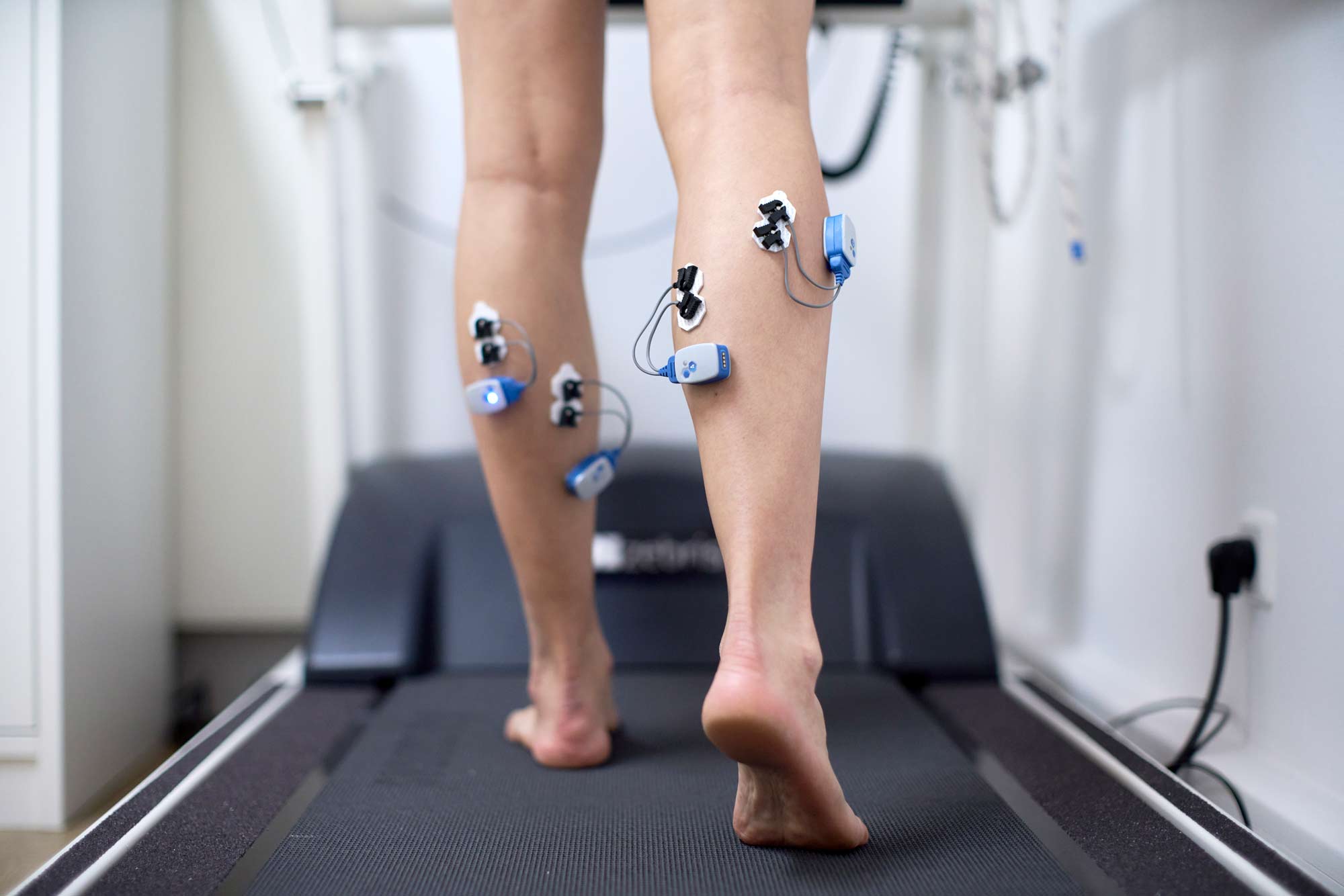 Muskelfunktionsdiagnostik (EMG-Analyse) | Bonn Orthopäde Orthopädie ...